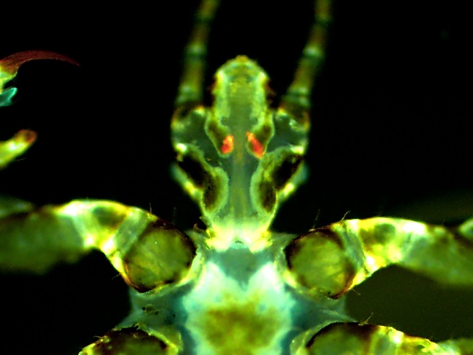 bubonic plague flea bite