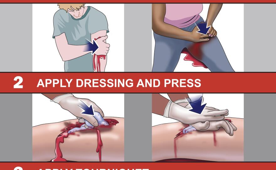 how do paramedics stop bleeding