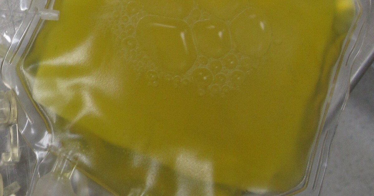 yellowish plasma