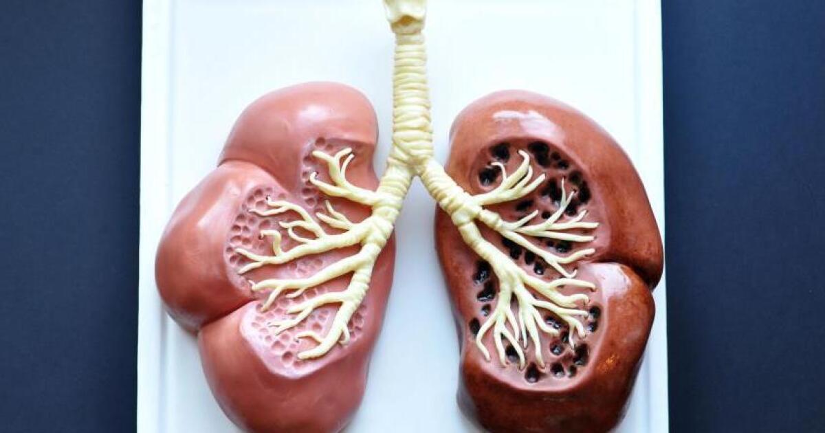 Museum Teaches Anatomy And Disease With Ghoulish Body Part Bake-Off | WUNC