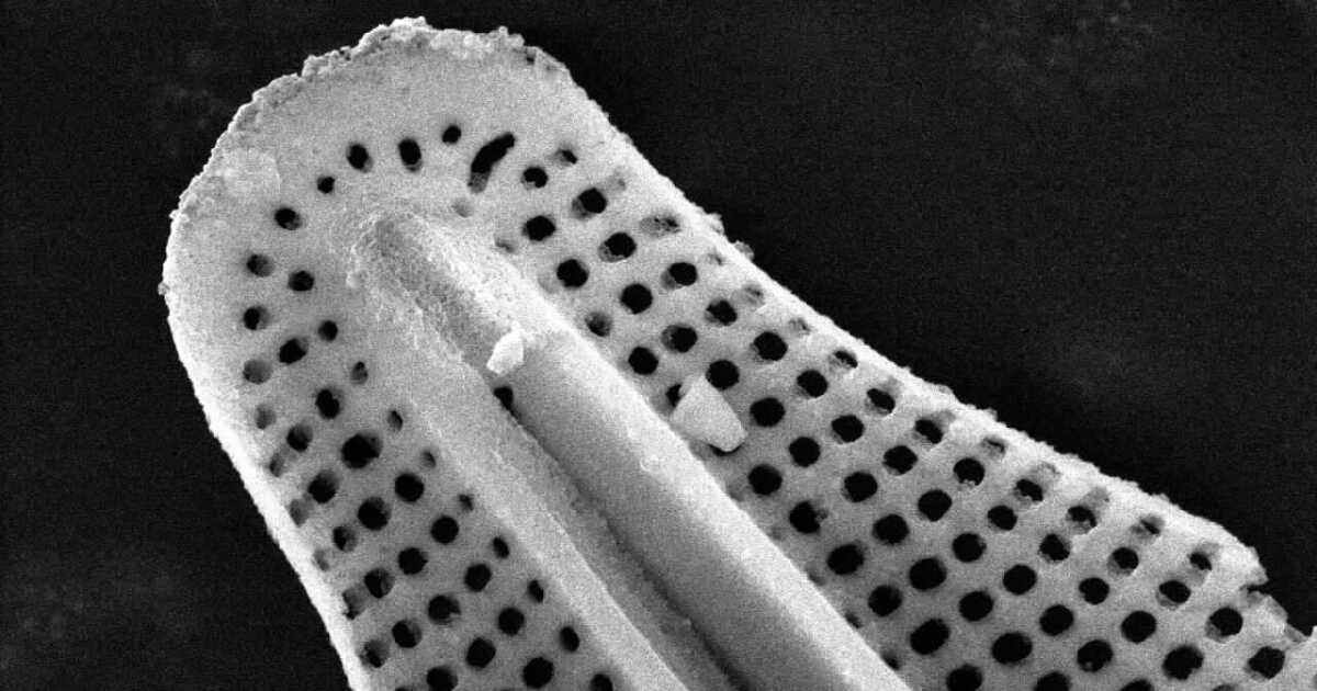 diatom under electron microscope