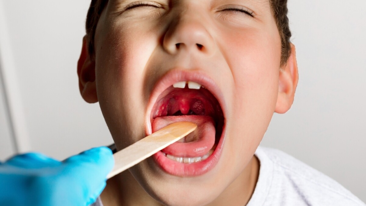 tonsil removal procedure called