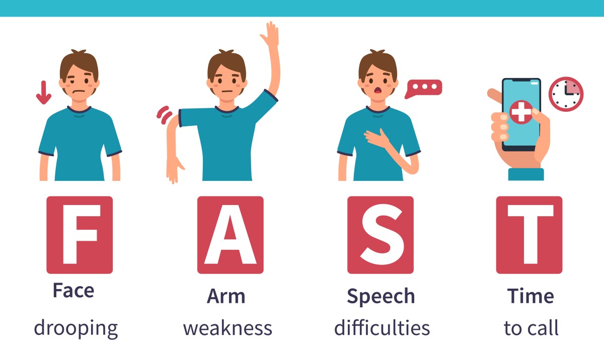 stroke symptoms face droop