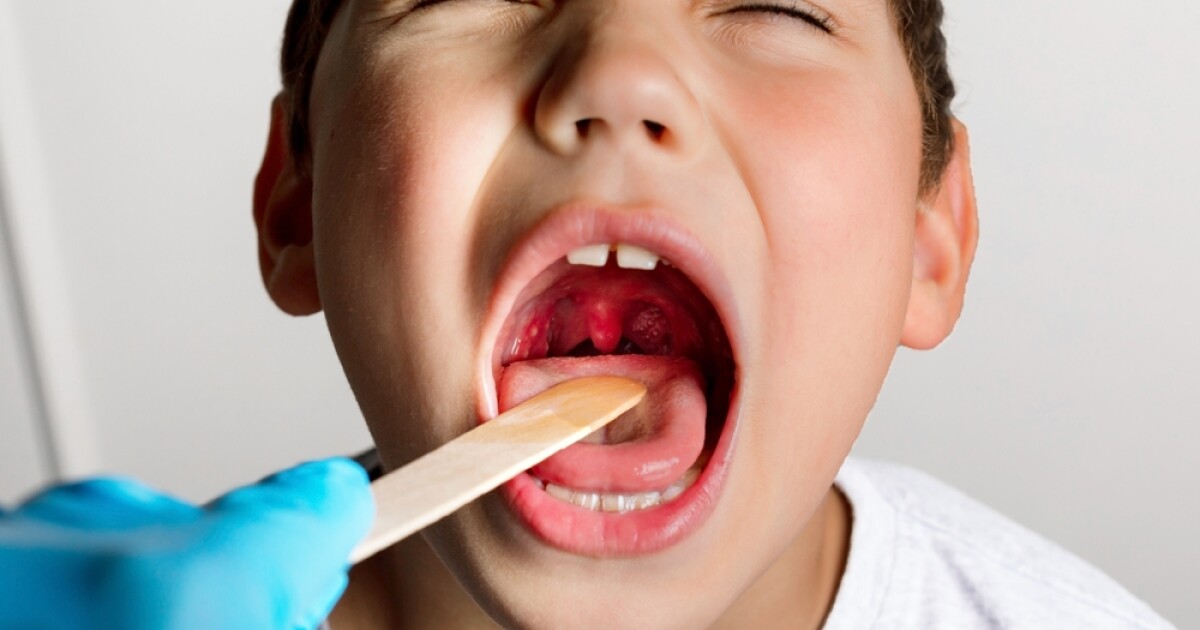 tonsillectomy surgery risks