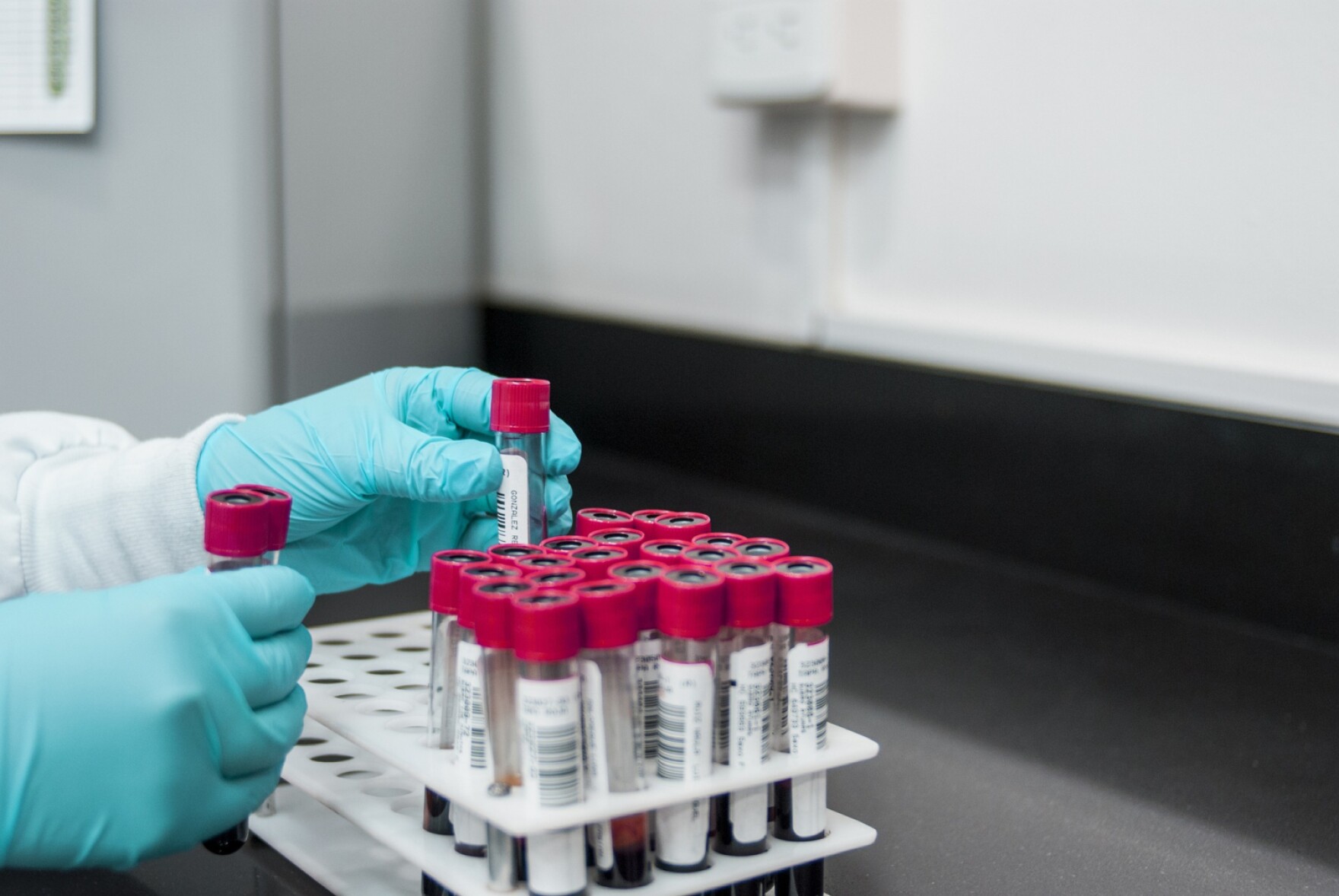 A simple blood test can detect colorectal cancer early, study finds